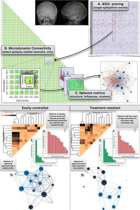 Network Investigation Of Short Lived Epileptic Networks By I Am Dimitris Medium