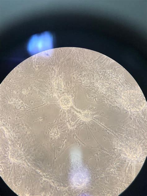 Any Advice About Unusual Structures In Primary Neuronal Cultures