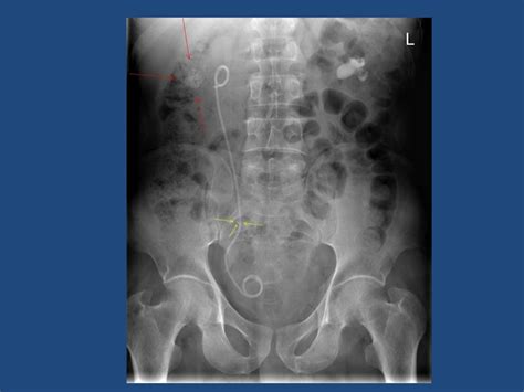 Git Radiology