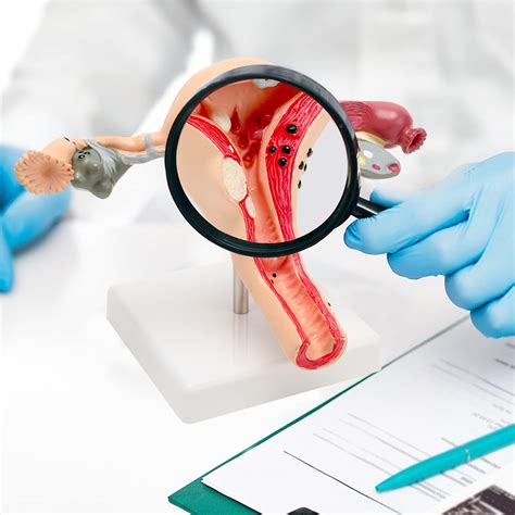 Life Size Human Uterus And Ovary Model Pathological Uterus Model Lyou