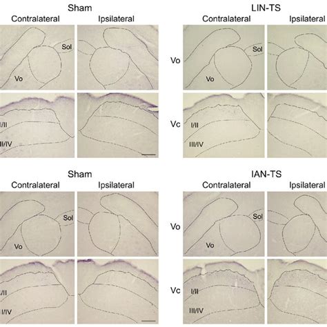 C Fos Immunoreactivity Elicited By Noxious Tongue Stimulation With