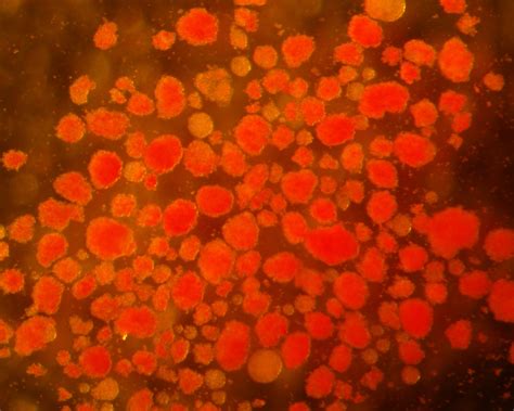 Human Islet Isolation Procedure Human Islet Transplant Laboratory