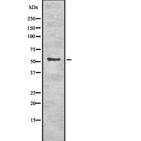 Mst1 Mst2 Polyclonal Antibody Pa5 103144