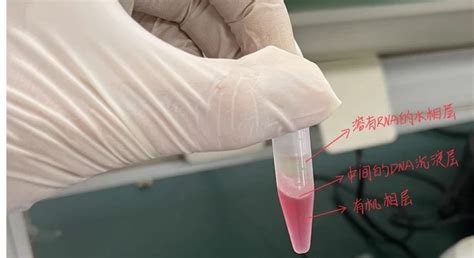 超详细lncrna的提取方法——总rna的提取 哔哩哔哩