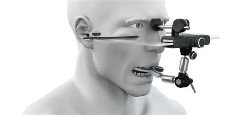 Arco Facial Estandar Bioart Julvipdent