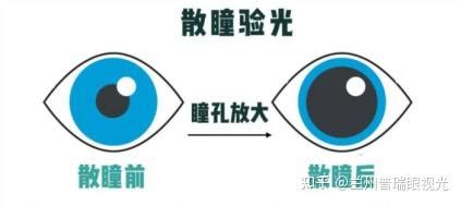 近视手术前需要散瞳到底有没有必要 知乎