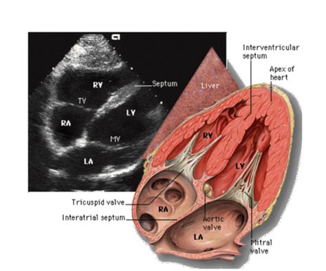 Relational And Structural Anatomy And Right Heart Flashcards Quizlet