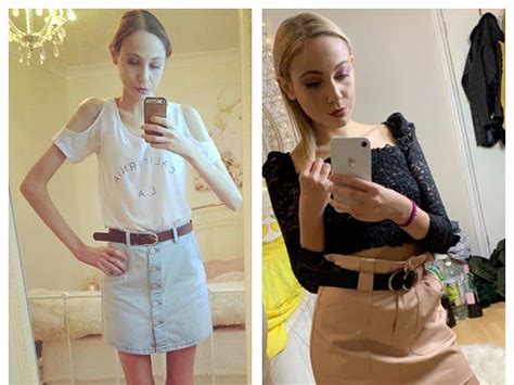 Instagram Cracking Down On Eating Disorder Supporting Community