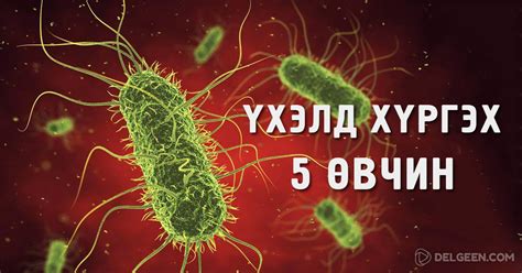 Хорт хавдар зүрхний шигдээсээс ч илүү аюултай 5 өвчин Хүмүүс эдгээрт