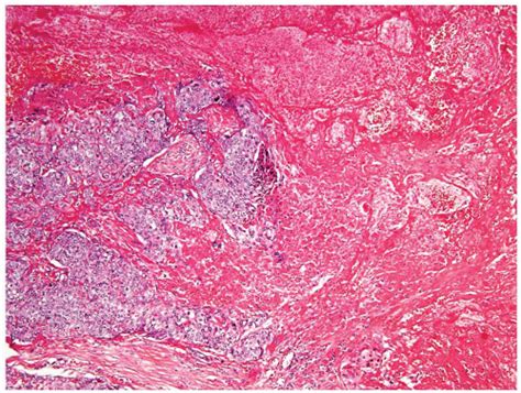 Testis Basicmedical Key