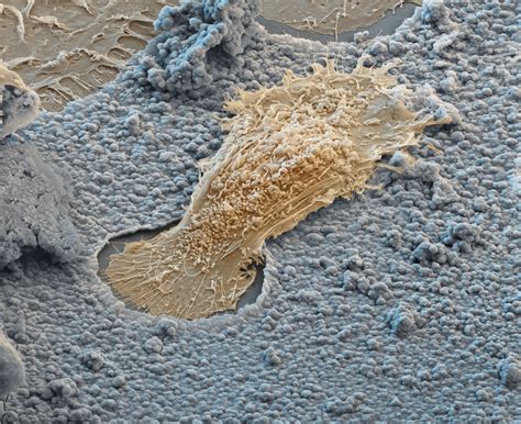 Osteoclast Cell Sem Stock Image C0578529 Science Photo Library
