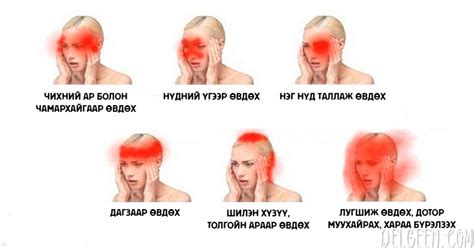 Толгой аль хэсгээрээ яаж өвдөж байгаагаас хамаарч эрүүл мэндэд ямар