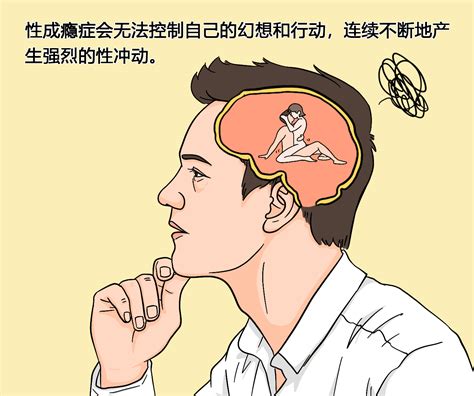 性成瘾症表现 有来医生