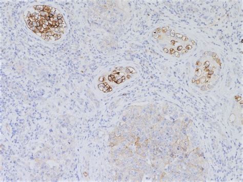 Cd117 Antibody Lexicon