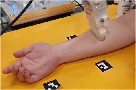 An Example Of Ultrasonic Examination Download Scientific Diagram