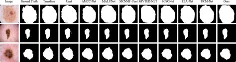 frontiers multi conv attention network for skin lesion image segmentation