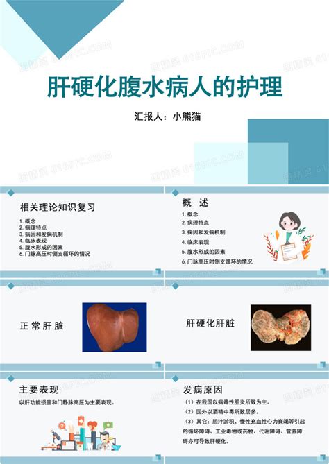 简约风肝硬化腹水病人的护理ppt模板免费下载编号vrecrq2pz图精灵