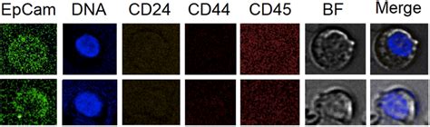 Two Examples Of Circulating Epithelial Cells Detected In Post Surgery Download Scientific