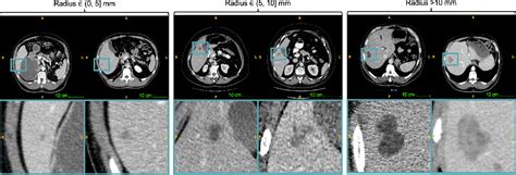Pdf Label Free Liver Tumor Segmentation Semantic Scholar