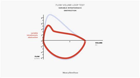 Tracheomalacia Flow Volume Loop