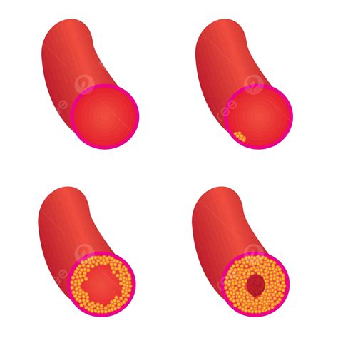cholesterol levels