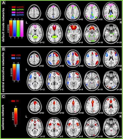 Long Term Effects Of RTMS Non Invasive Neurostimulation Therapies NINET Laboratory