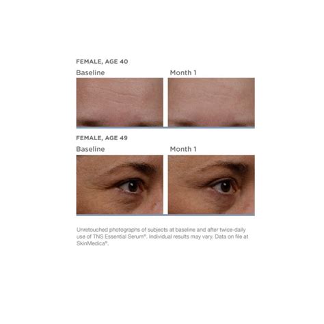 Skinmedica® Tns Advanced Serum®