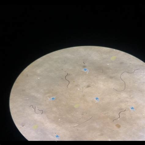 Microplastic Object Detection Model V6 Augmentationdataset By Walailak University