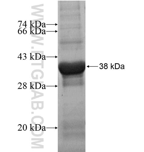 Unc5c Fusion Protein United Bio Research