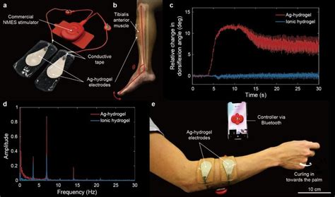 Neuromuscular Electrical Stimulation Nmes Electrode A Nmes Download Scientific Diagram