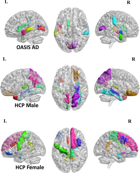 Signed Graph Representation Learning For Functional To Structural Brain Network Mapping