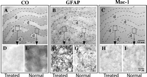 Photomicrographs Of Serial Tangential Sections Through Layer 4c Of V1
