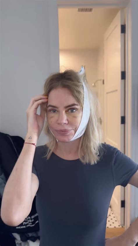 Caroline Stanbury Reveals Facelift Results