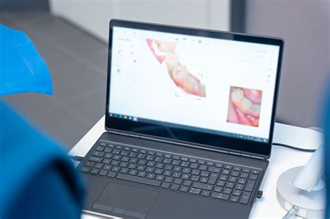 치과 진료소 컴퓨터로 환자에게 3d 스캔을 수행하는 치과 의사 치과에 대한 스톡 사진 및 기타 이미지 치과 컴퓨터 30