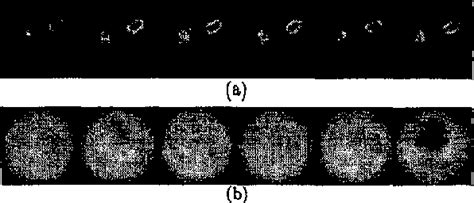 Figure 1 From Combined Fanparallel Beam Reconstruction In Cardiac