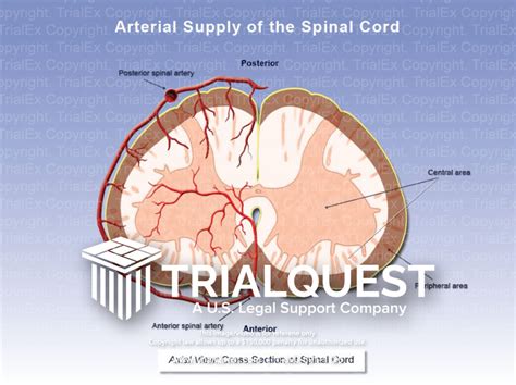Arterial Supply Of The Spinal Cord Trialexhibits Inc