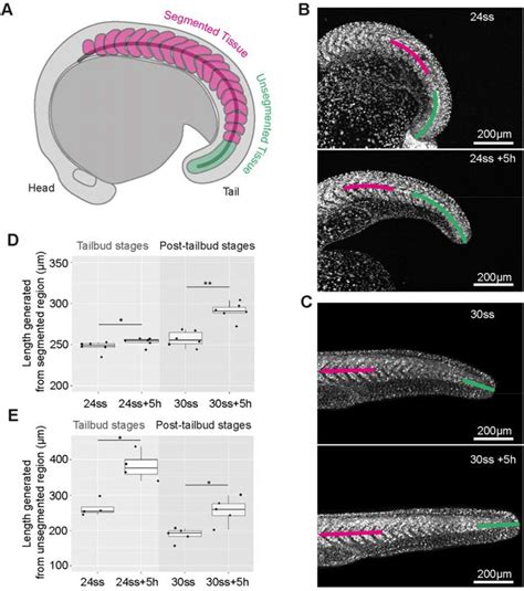 Notochord Notochord Cells In Intervertebral Disc Development And