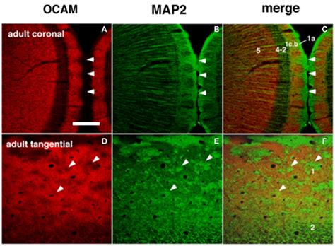 Frontiers Small Scale Module Of The Rat Granular Retrosplenial Cortex