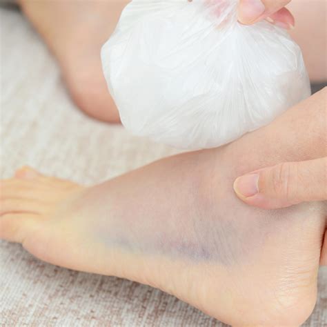 Metatarsal Stress Fracture Treatment Options