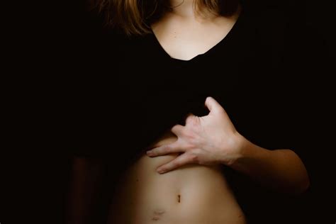Ulcerative Colitis My Uc Story Uc Diagnosis Meg Is Well