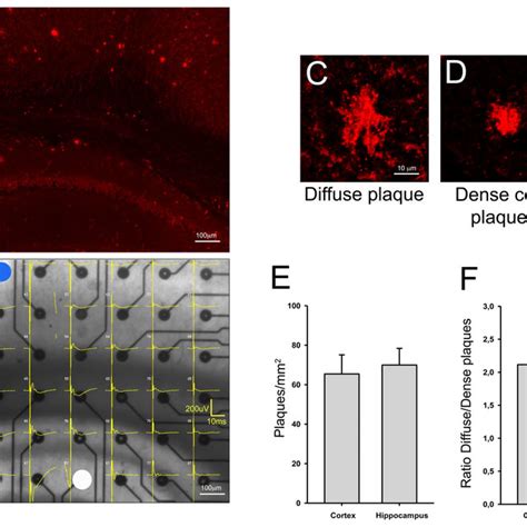 Basal Synaptic Transmission And Short Term Plasticity In Hippocampal