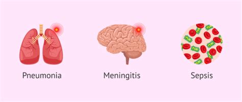 Streptococcus B Risks In New Born Babies