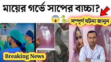 সাপের বাচ্চার জন্ম দিল এই মহিলা🐍😱 সাপের বাচ্চা জন্ম দিলে মহিলা আসল