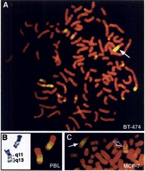Fish To Metaphase Chromosomes With The Probe Generated By Download