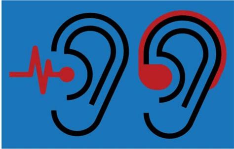 Dr Sumitha Nayak On Linkedin Hearingloss Dementia Dementiacare