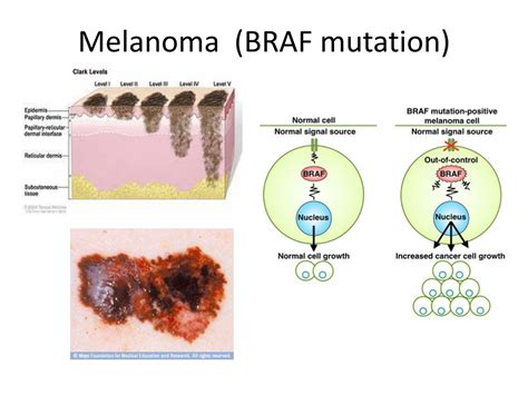 Ppt Mutations Powerpoint Presentation Free Download Id 411095