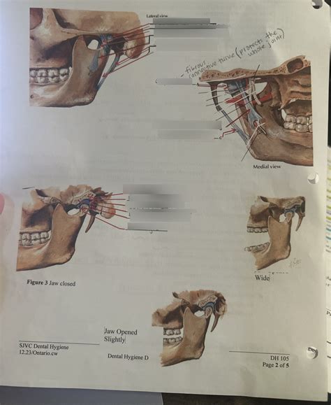 TMJ Diagram Quizlet