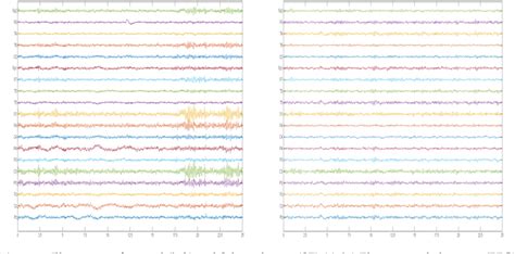 Figure 1 From Deep Convolutional Neural Network Model For Automated Diagnosis Of Schizophrenia