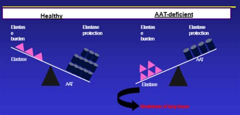 COPD Flashcards Quizlet