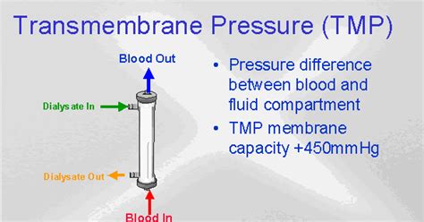 Hemodialysis Devices Dialysate Delivery System